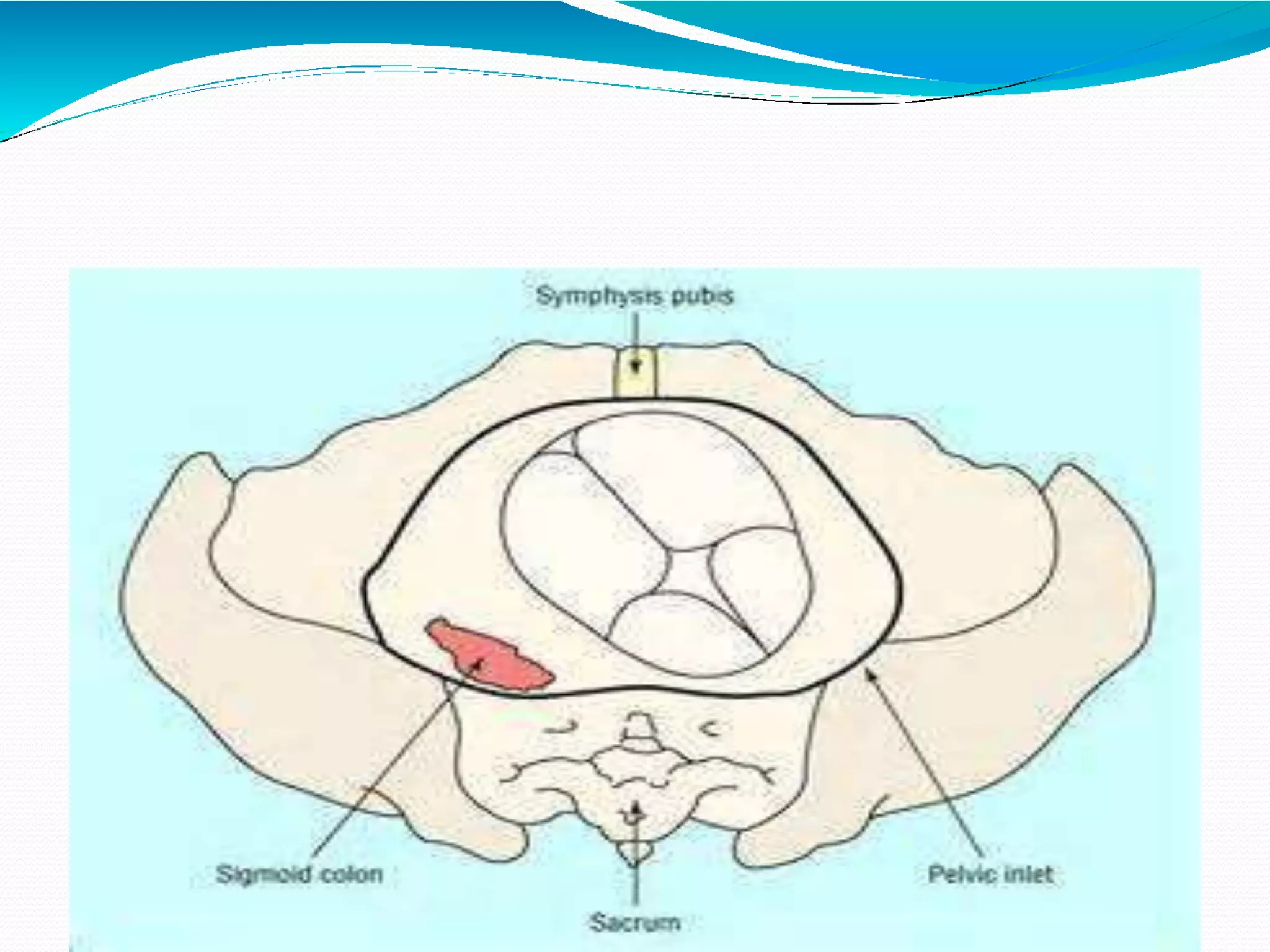 occipitoposteriorpositition-160811105500.pptx