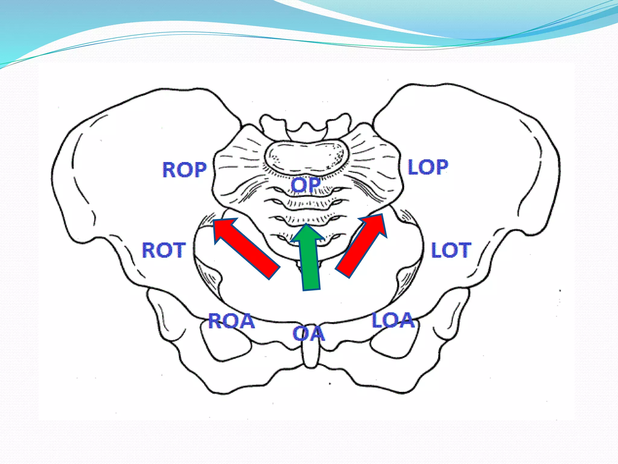 Occipito posterior positition | PPTX