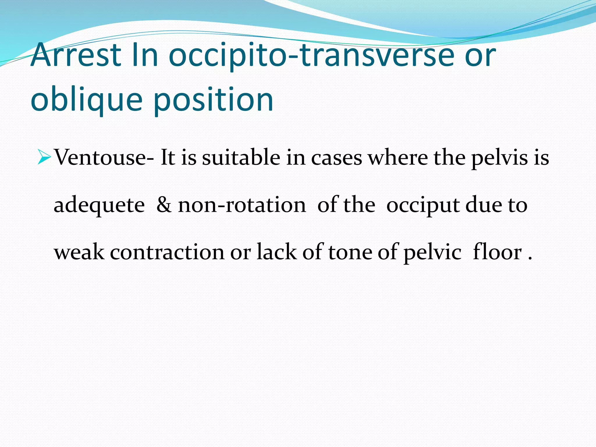 Occipito posterior positition | PPTX