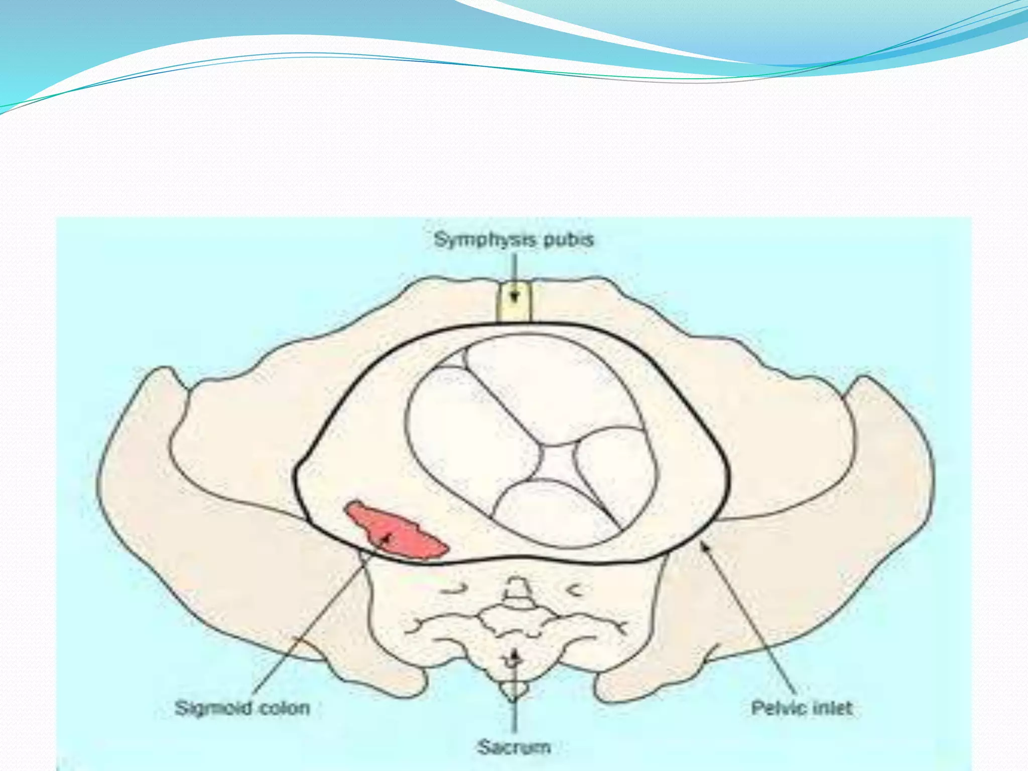 Occipito posterior positition | PPTX