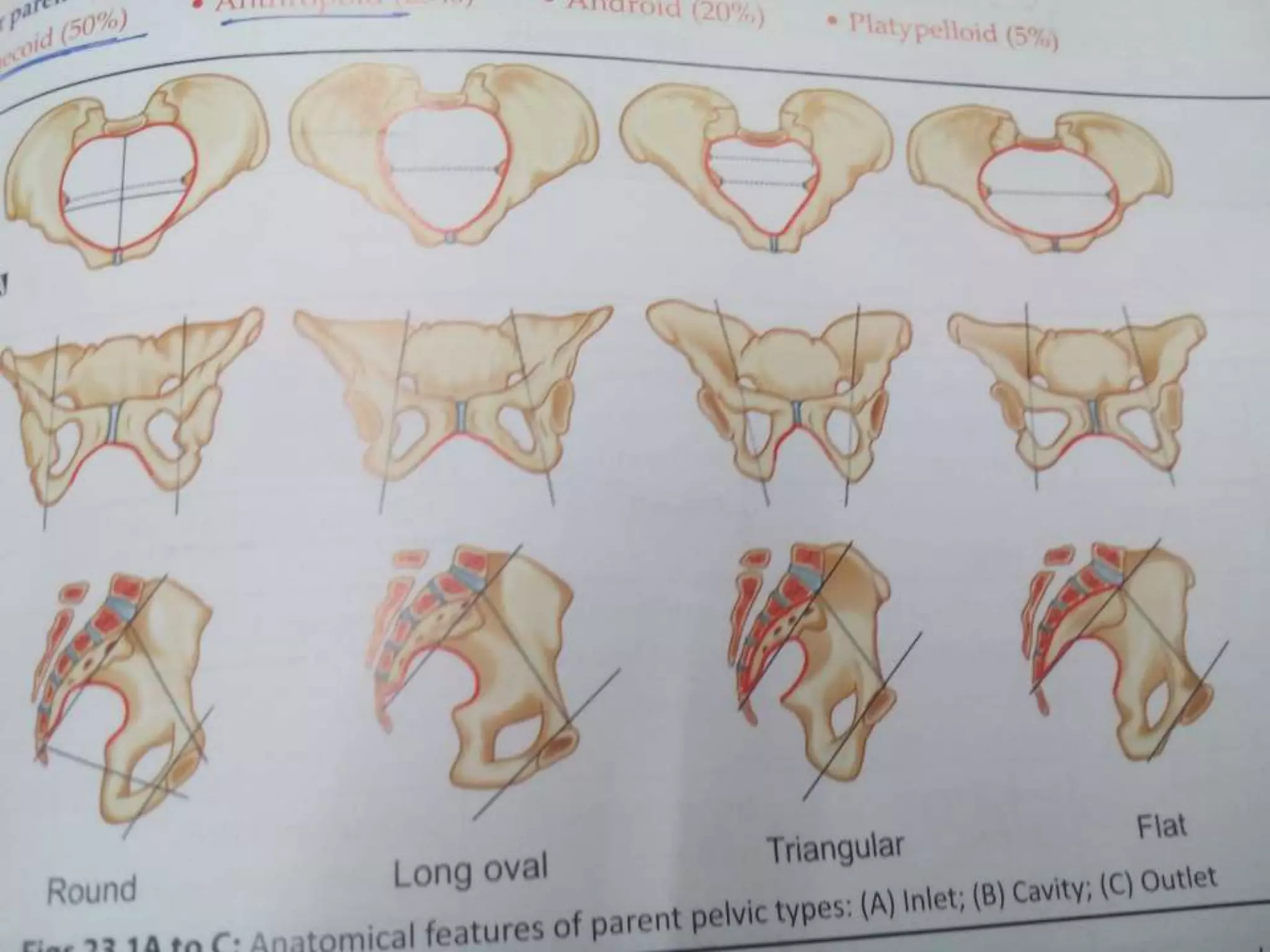 Occipito posterior positition | PPTX