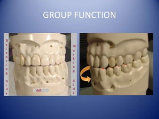 Occluion in prosthodontics | PPTX