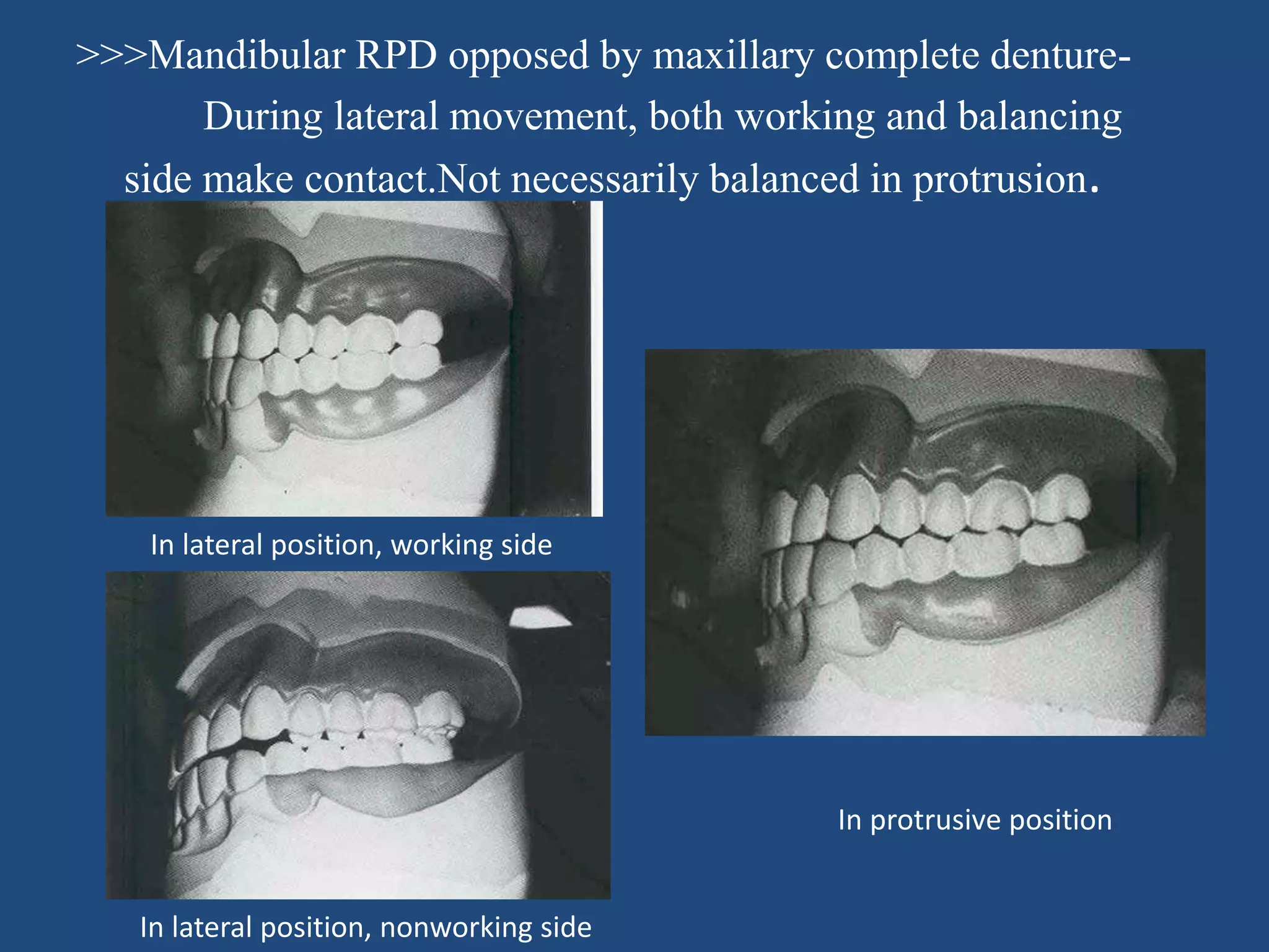 Occluion in prosthodontics lec 16 04-'13 | PPTX