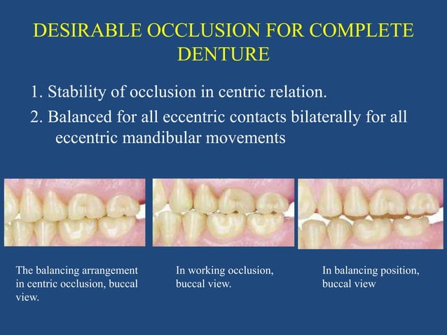 Occluion in prosthodontics lec 16 04-'13 | PPTX | Dental Health | Diseases and Conditions