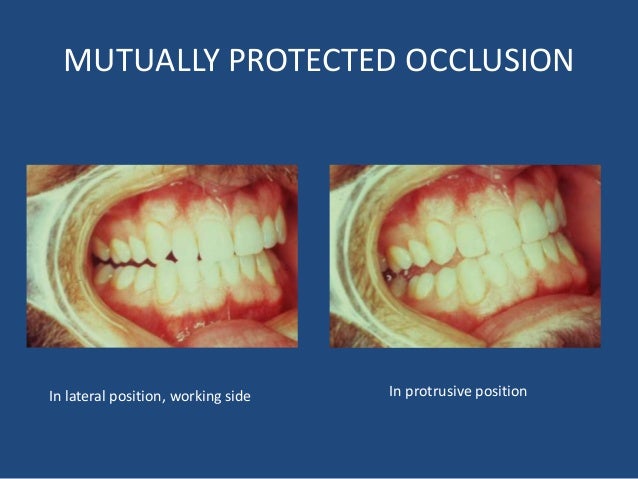 Occluion in prosthodontics lec 16 04-'13