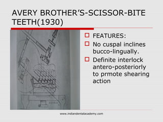 Developments in the Occlusal patterns of artificial Teeth / orthodontic ...