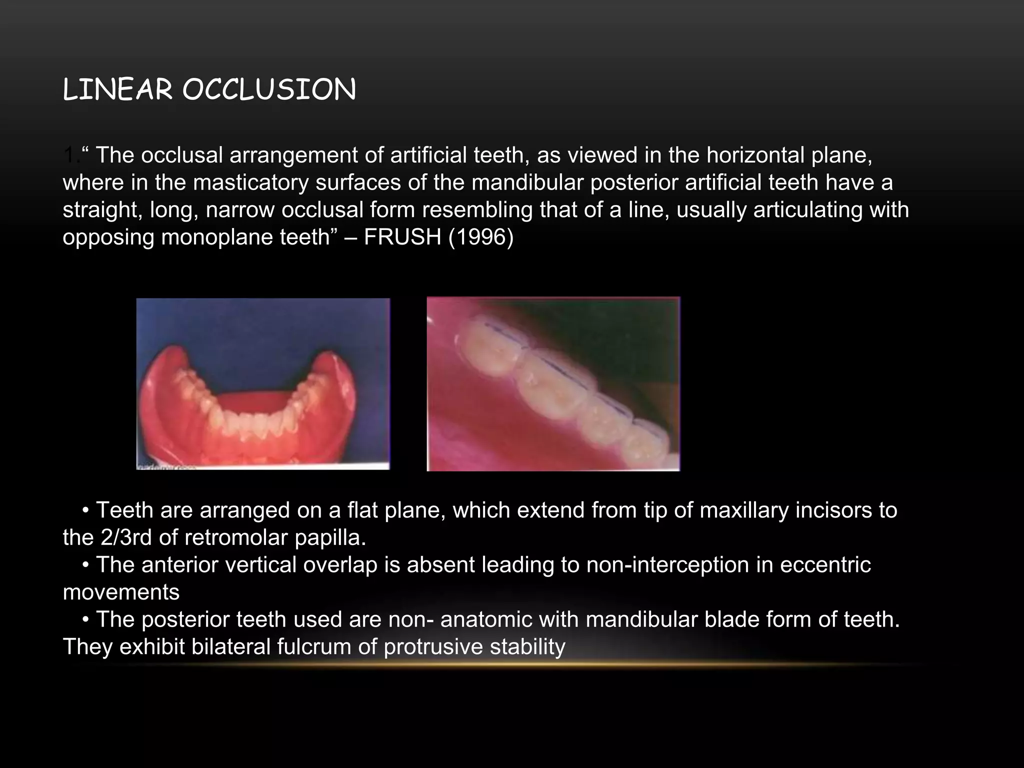 Occlusal adjustments in cd | PPTX | Dental Health | Diseases and Conditions