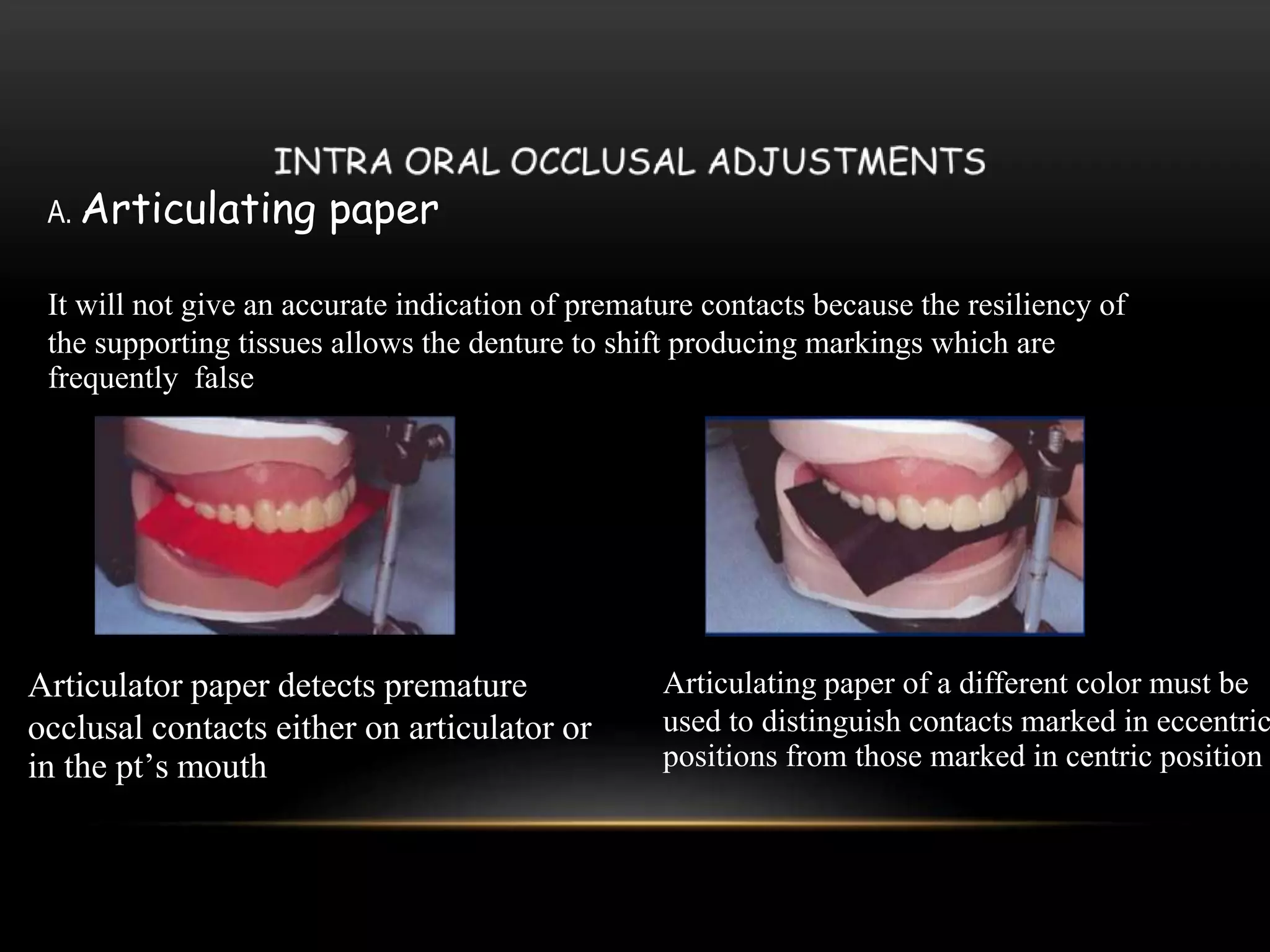 Occlusal adjustments in cd | PPTX | Dental Health | Diseases and Conditions