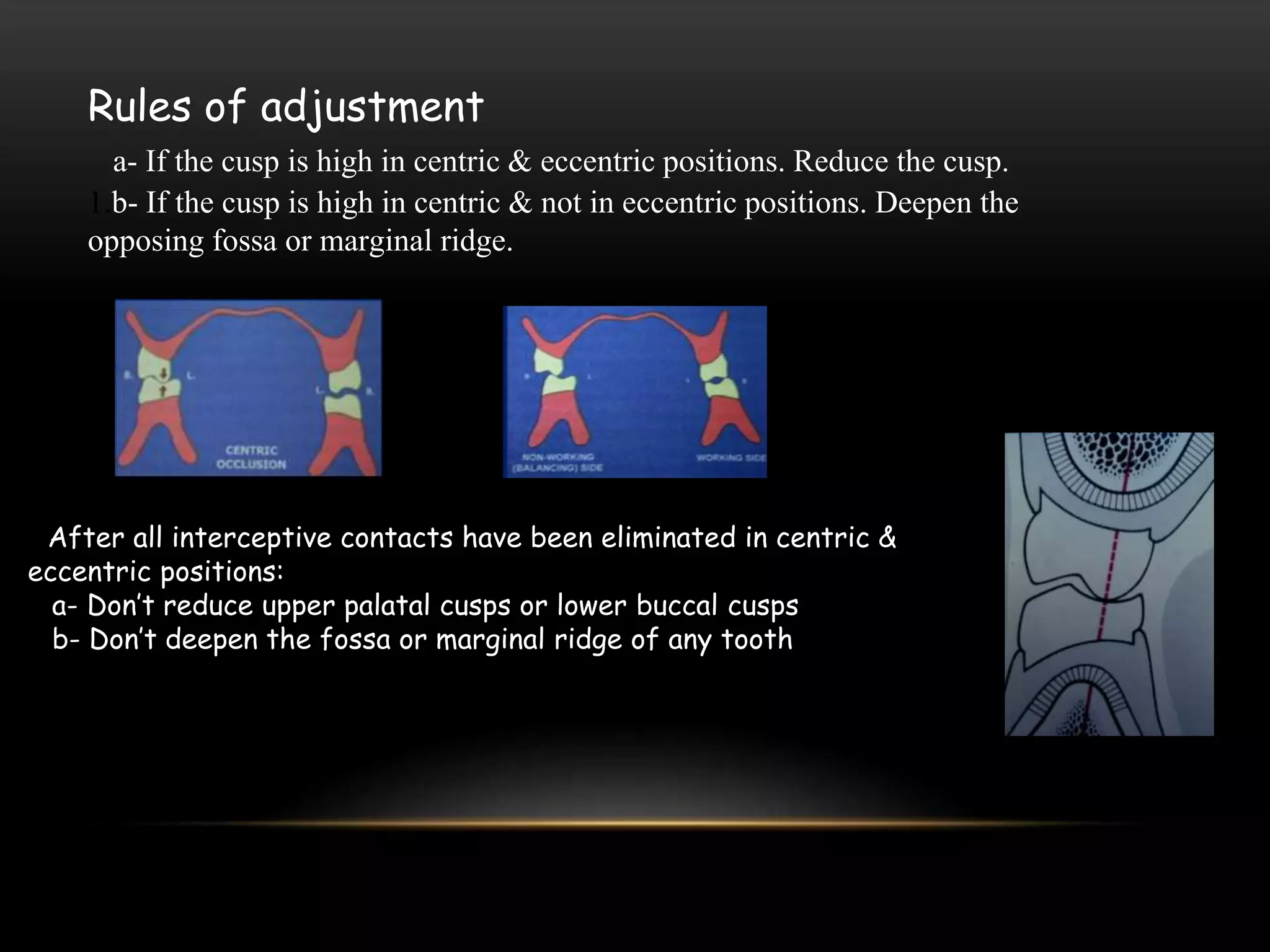 Occlusal adjustments in cd | PPTX | Dental Health | Diseases and Conditions