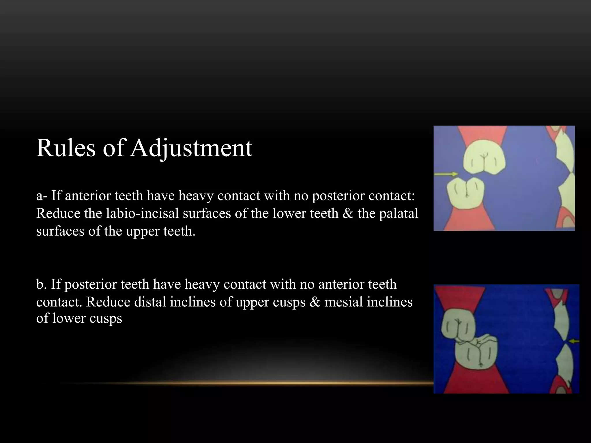 Occlusal adjustments in cd | PPTX | Dental Health | Diseases and Conditions