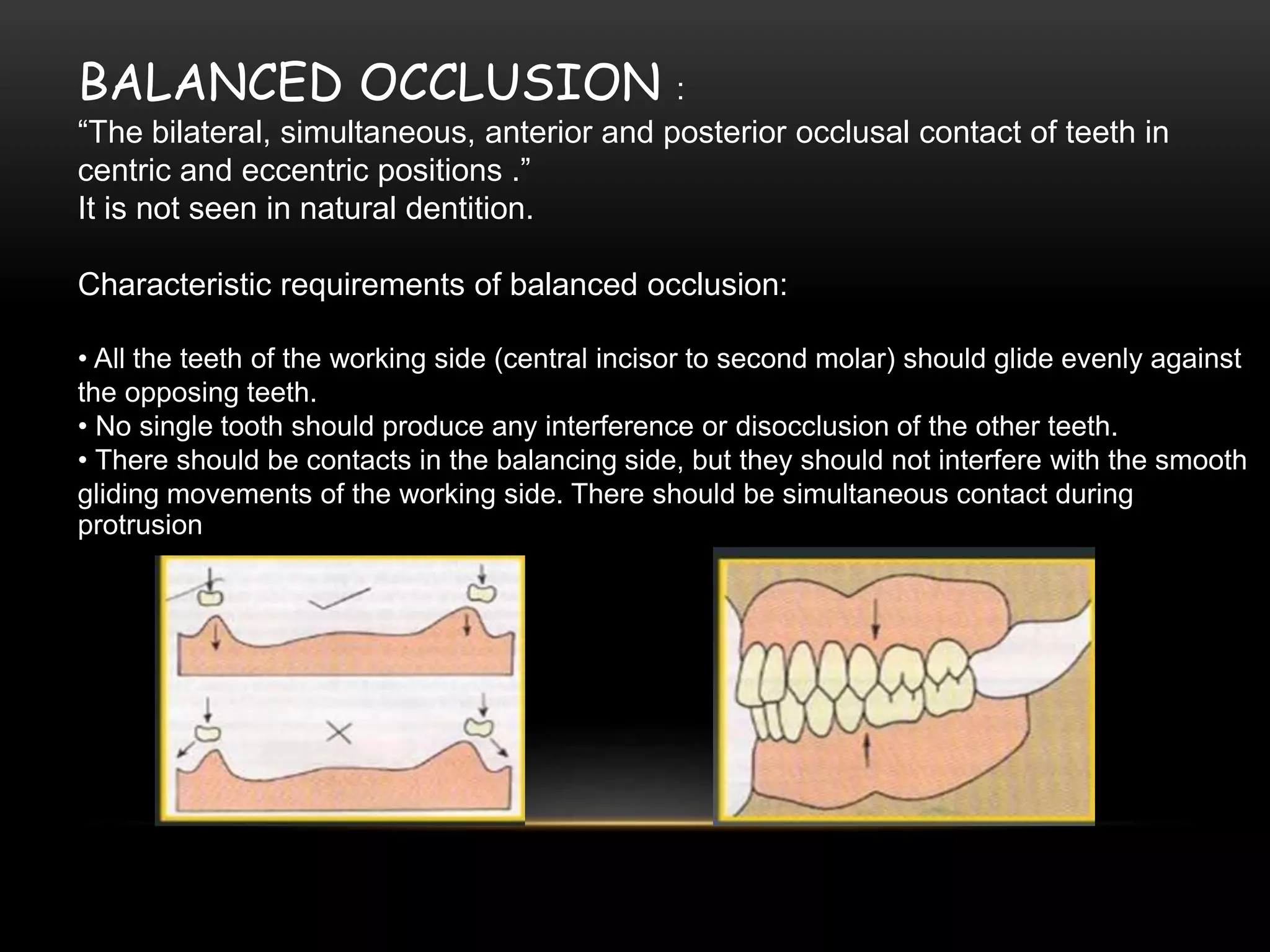 Occlusal adjustments in cd | PPTX | Dental Health | Diseases and Conditions