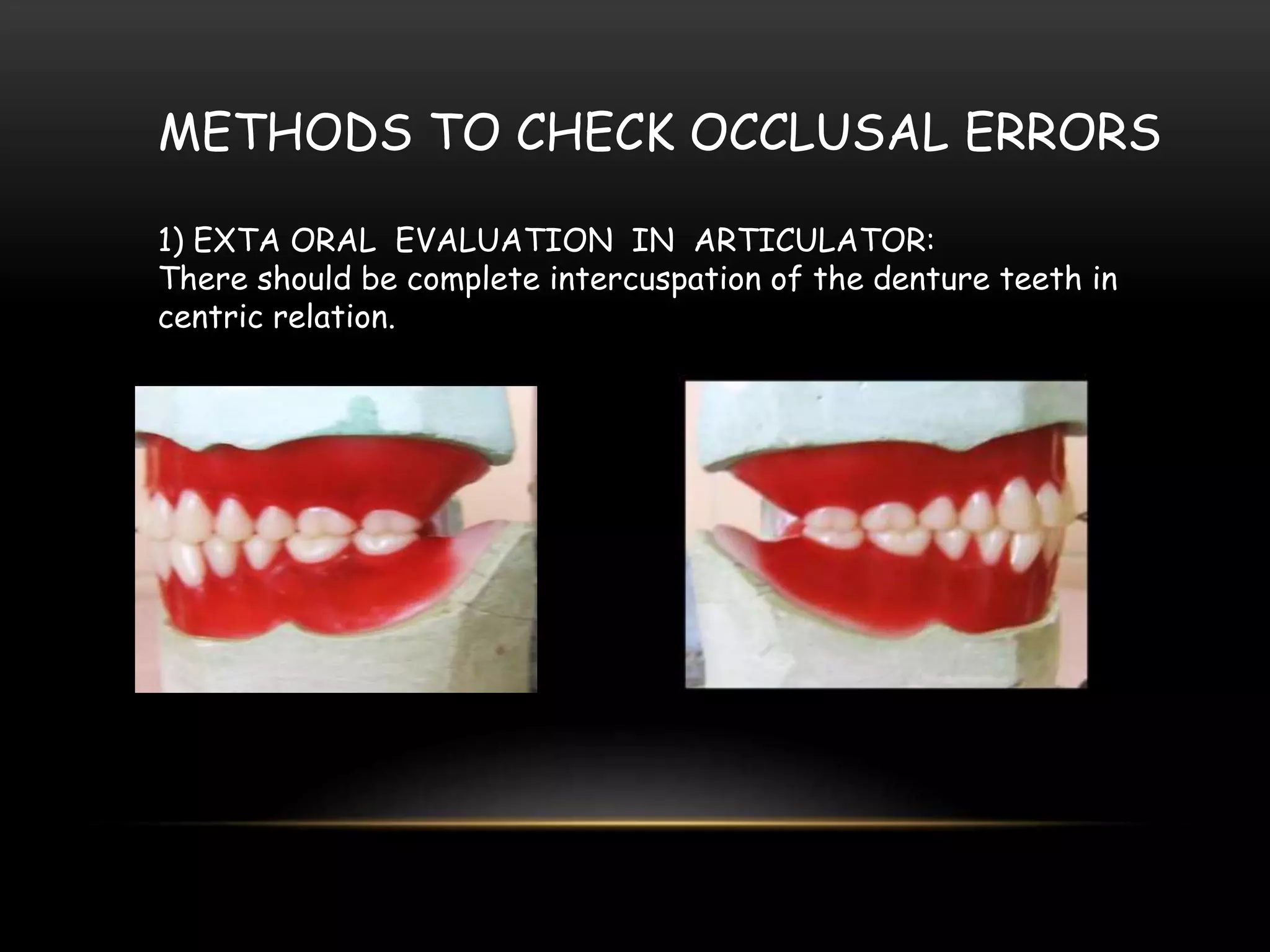 Occlusal adjustments in cd | PPTX