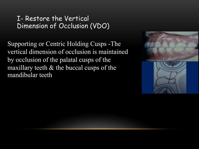 Occlusal adjustments in cd | PPTX