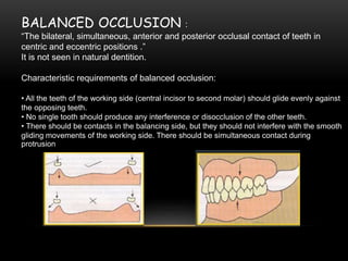 Occlusal adjustments in cd | PPTX