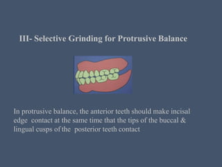 occlusal adjustment in cd.pptx
