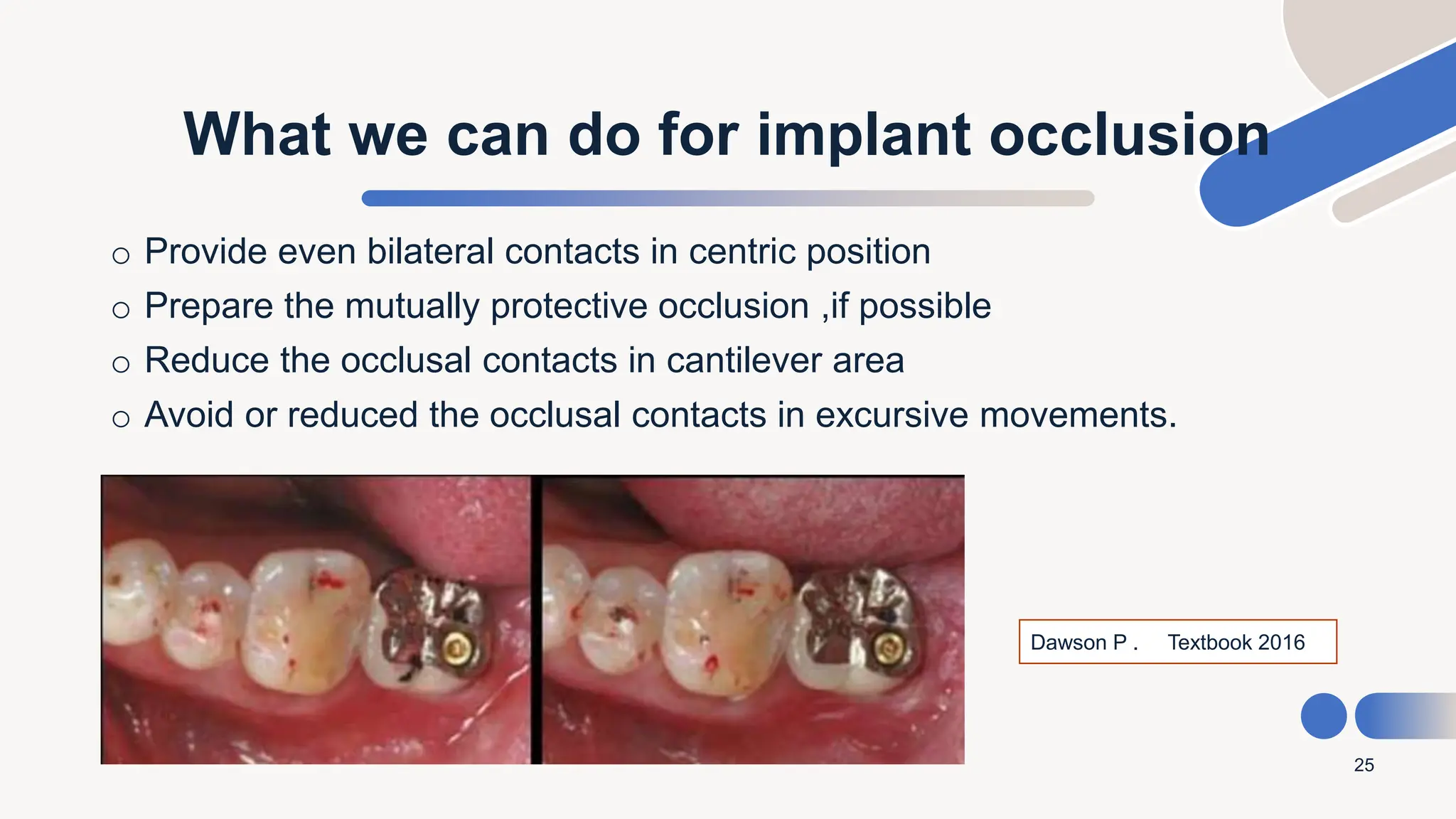 occlusal and prosthetic therapy (2).pptx