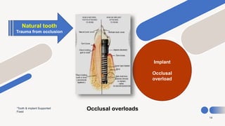 occlusal and prosthetic therapy final.pptx