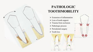 occlusal and prosthetic therapy final.pptx
