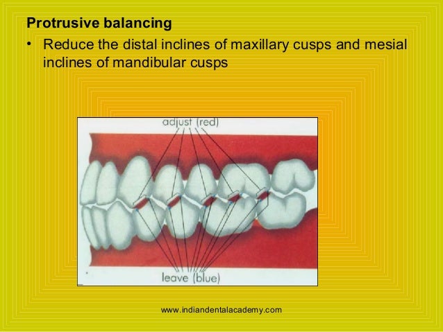Occlusal assesment/ dental courses