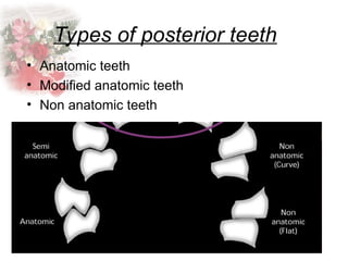 OCCLUSAL CONCEPTS IN COMPLETE DENTURE 1.ppt