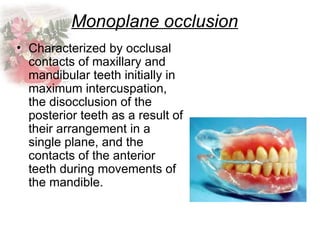 OCCLUSAL CONCEPTS IN COMPLETE DENTURE 1.ppt