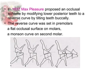 OCCLUSAL CONCEPTS IN COMPLETE DENTURE 1.ppt