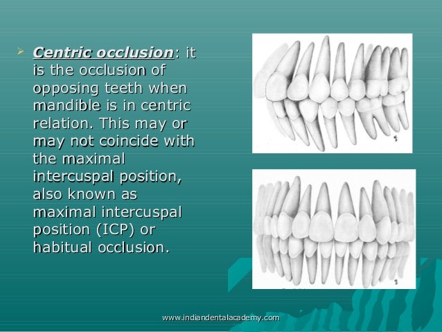 Occlusion concepts part 1 / dental courses
