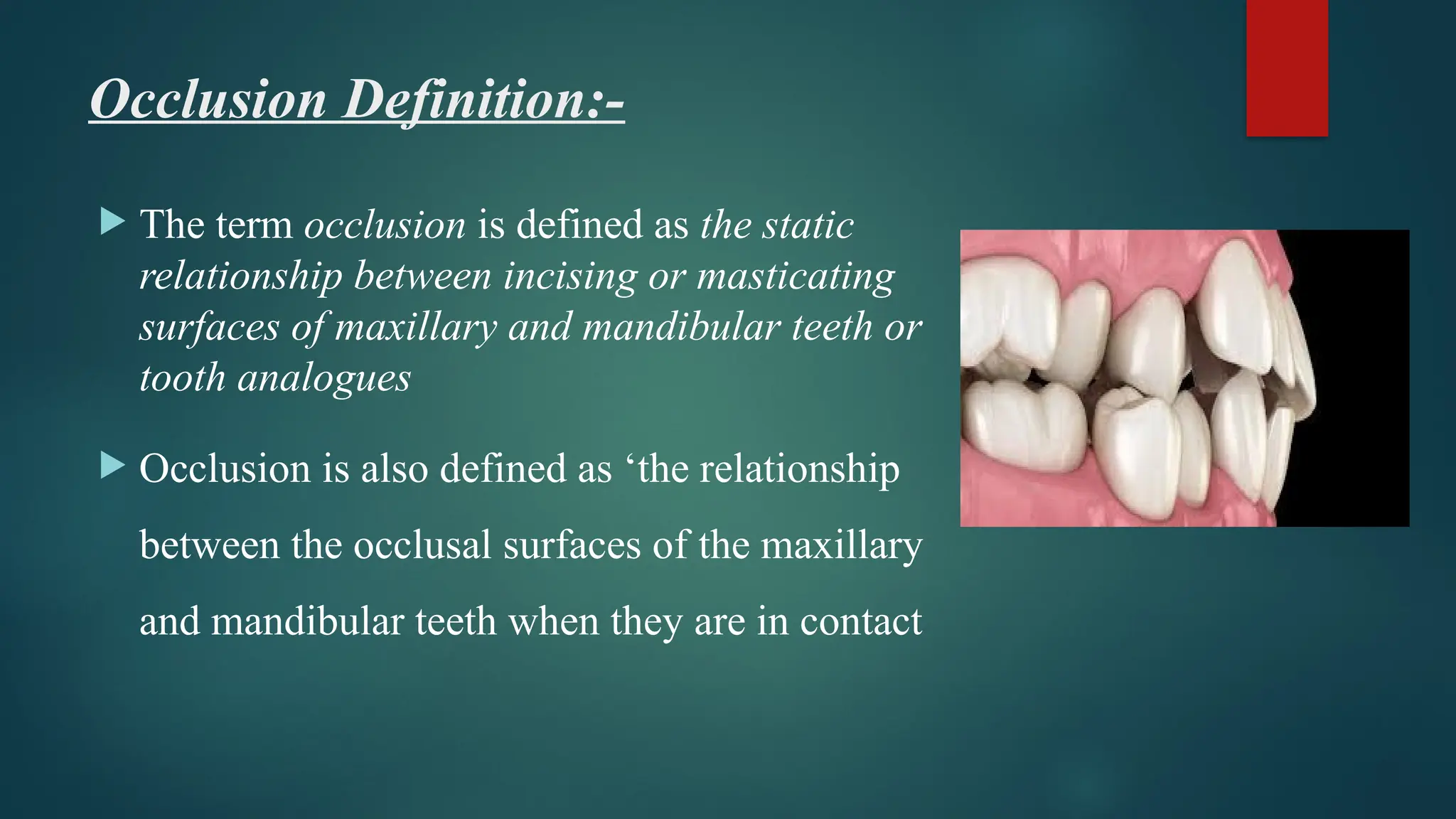 occlusal consideration s in operative dentistry.pptx