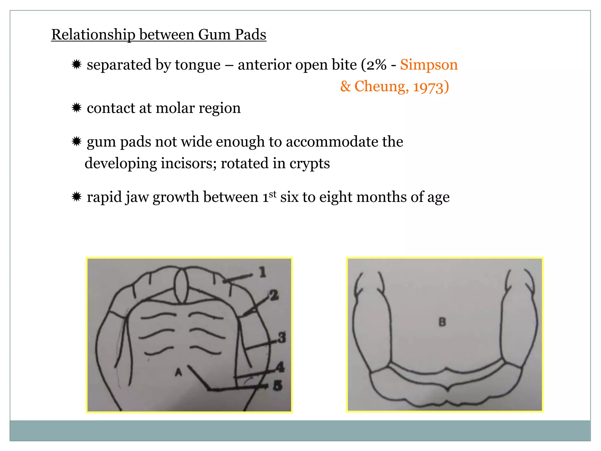 Occlusal developmental disturbances.pptx
