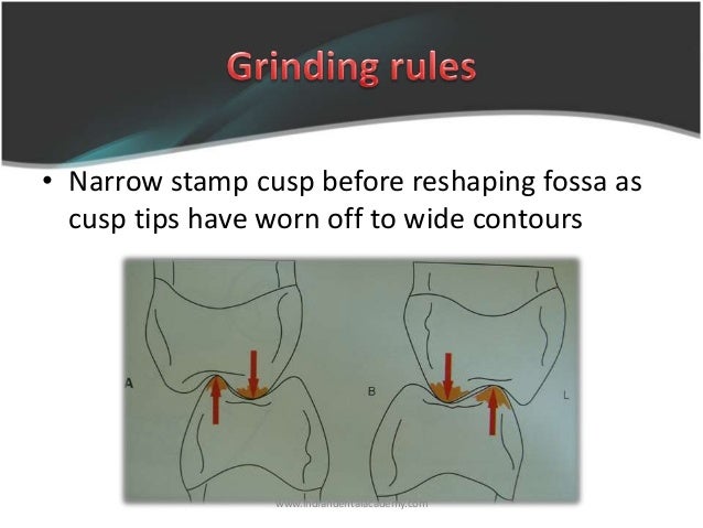 Occlusal equilibration./ orthodontic seminars