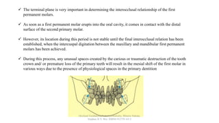 Occlusal guidance | PDF