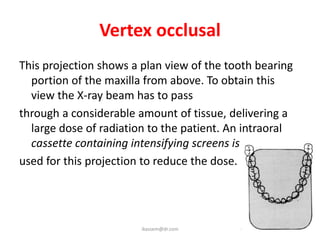 Occlusal max | PDF