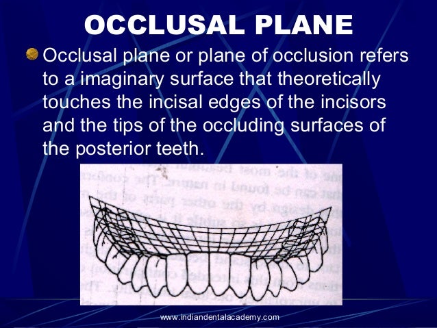 Occlusal plane/ orthodontic seminars