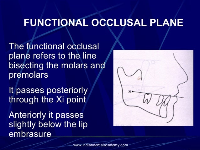 Occlusal plane/ orthodontic seminars