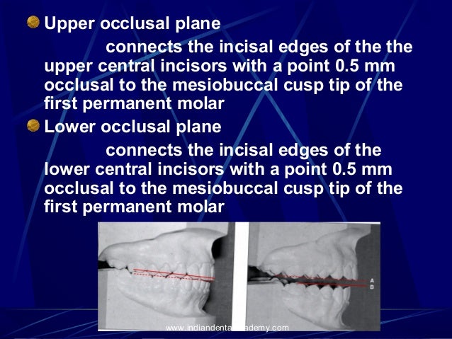 Occlusal plane/ orthodontic seminars