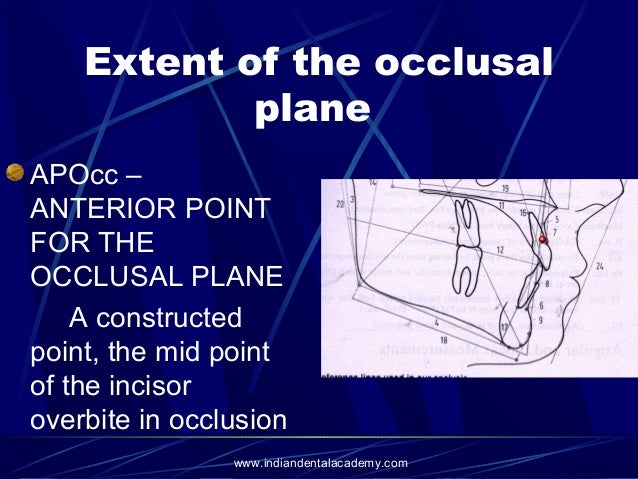 Occlusal plane/ orthodontic seminars