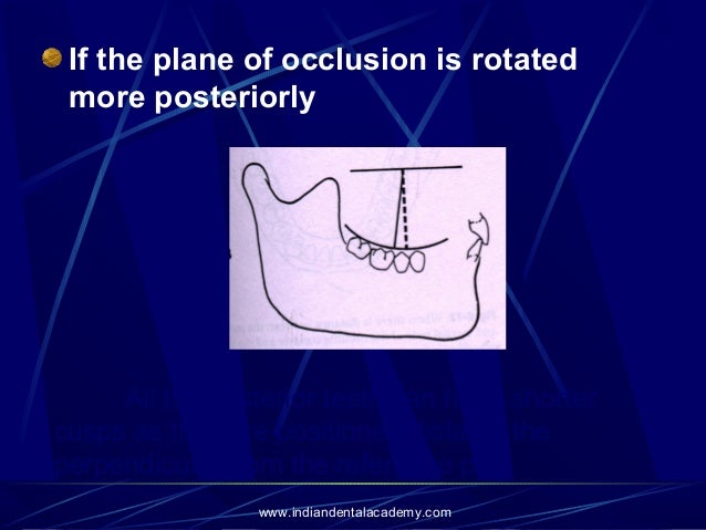Occlusal plane/ orthodontic seminars