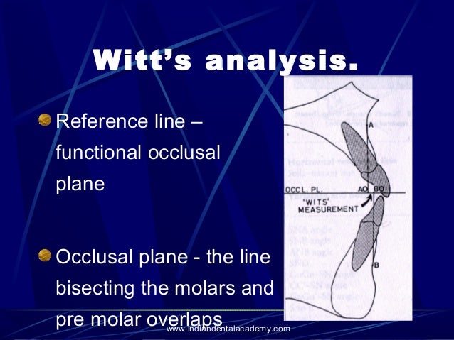 Occlusal plane/ orthodontic seminars