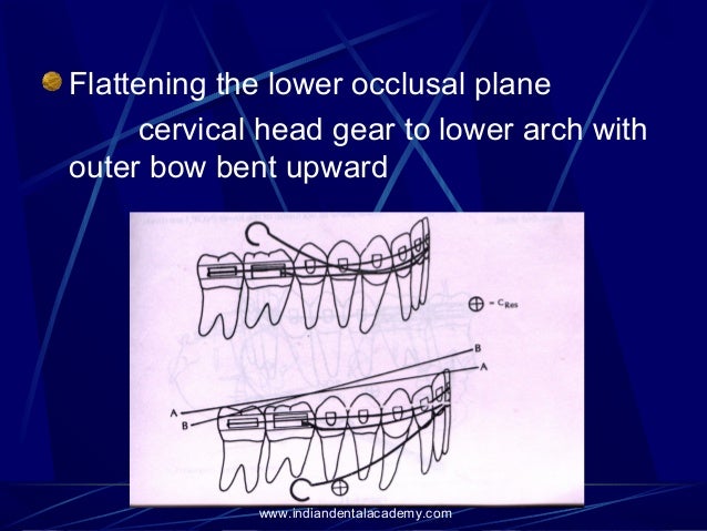 Occlusal plane/ orthodontic seminars