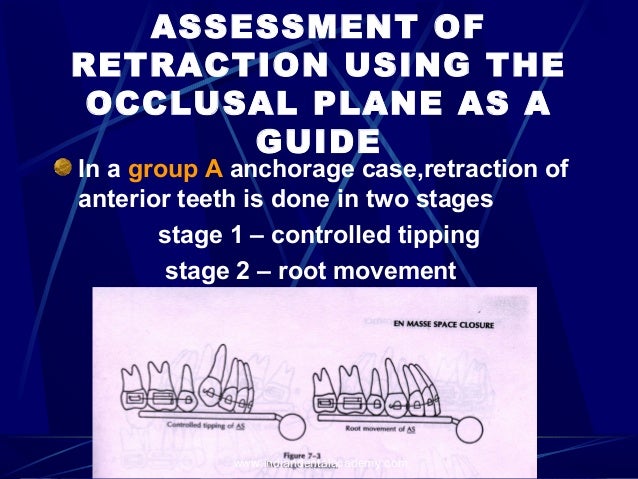 Occlusal plane/ orthodontic seminars