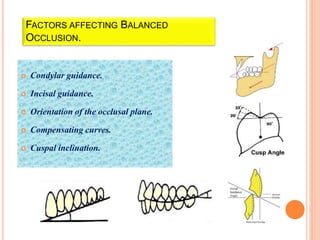 Occlusal planes and compensating curves | PPTX