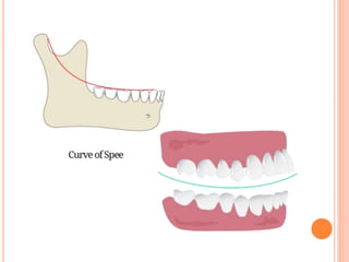 Occlusal planes and compensating curves | PPTX