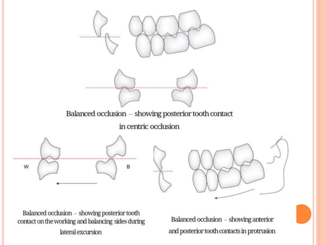 Occlusal planes and compensating curves | PPTX
