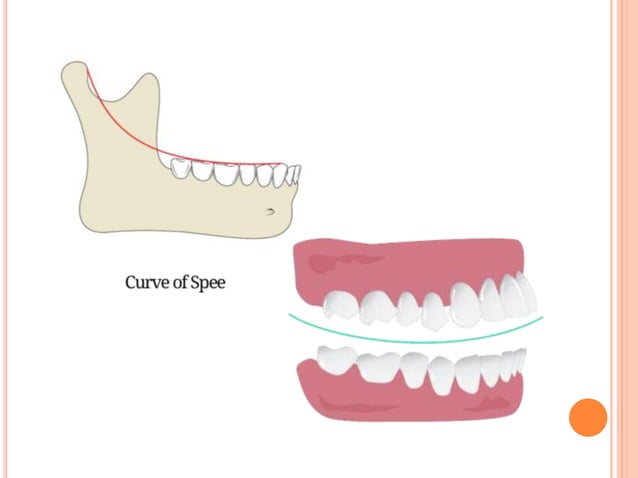 Occlusal planes and compensating curves | PPT
