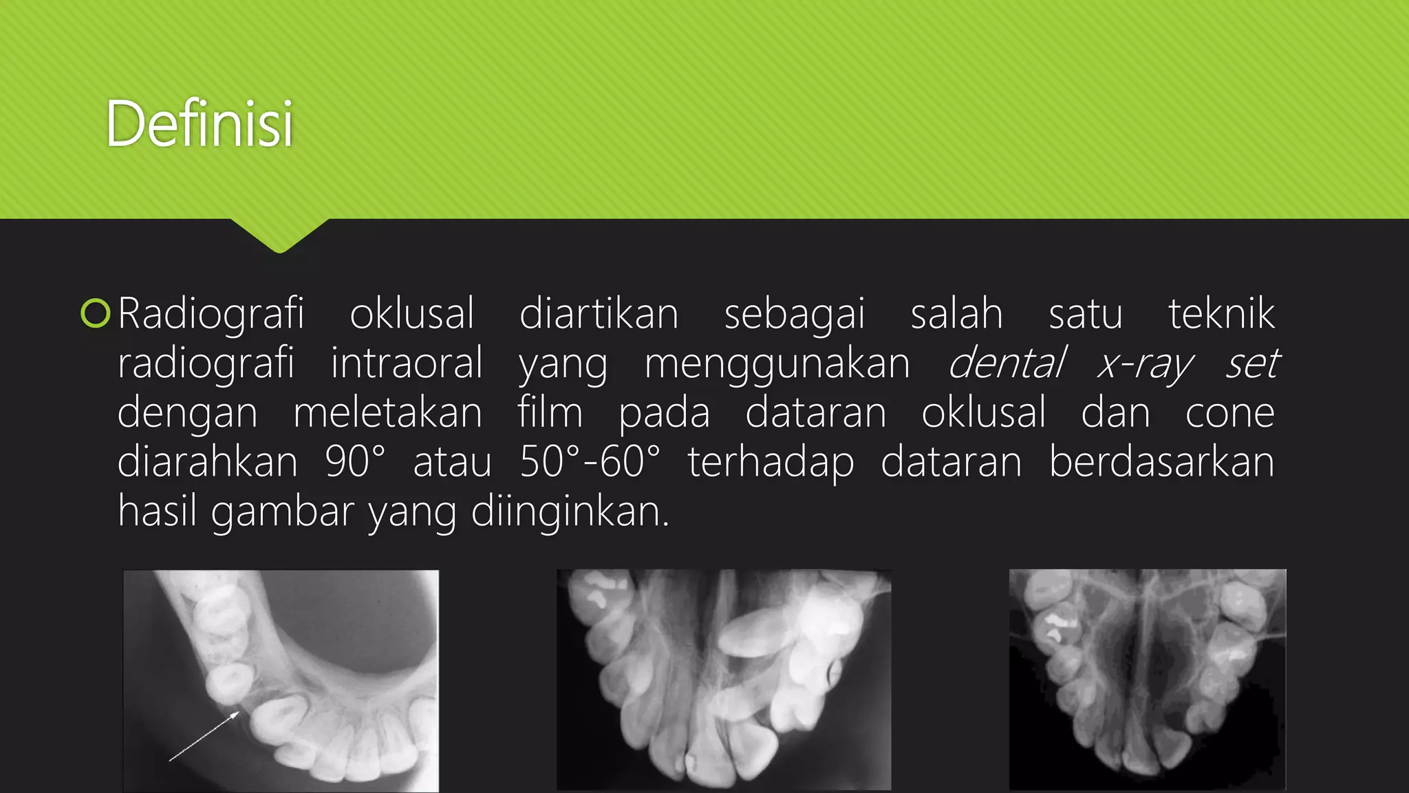Occlusal Radiograph.pptx
