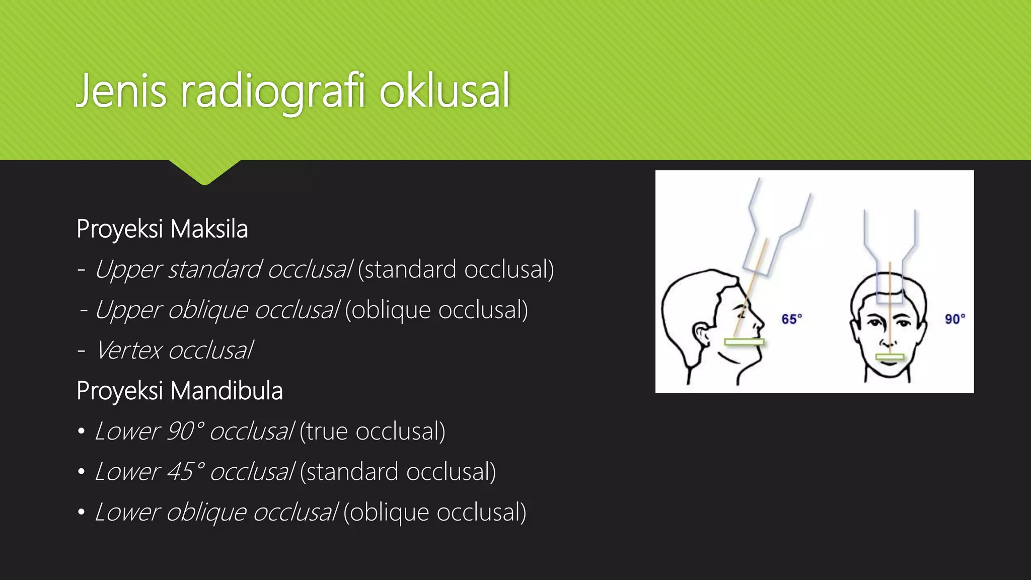 Occlusal Radiograph.pptx