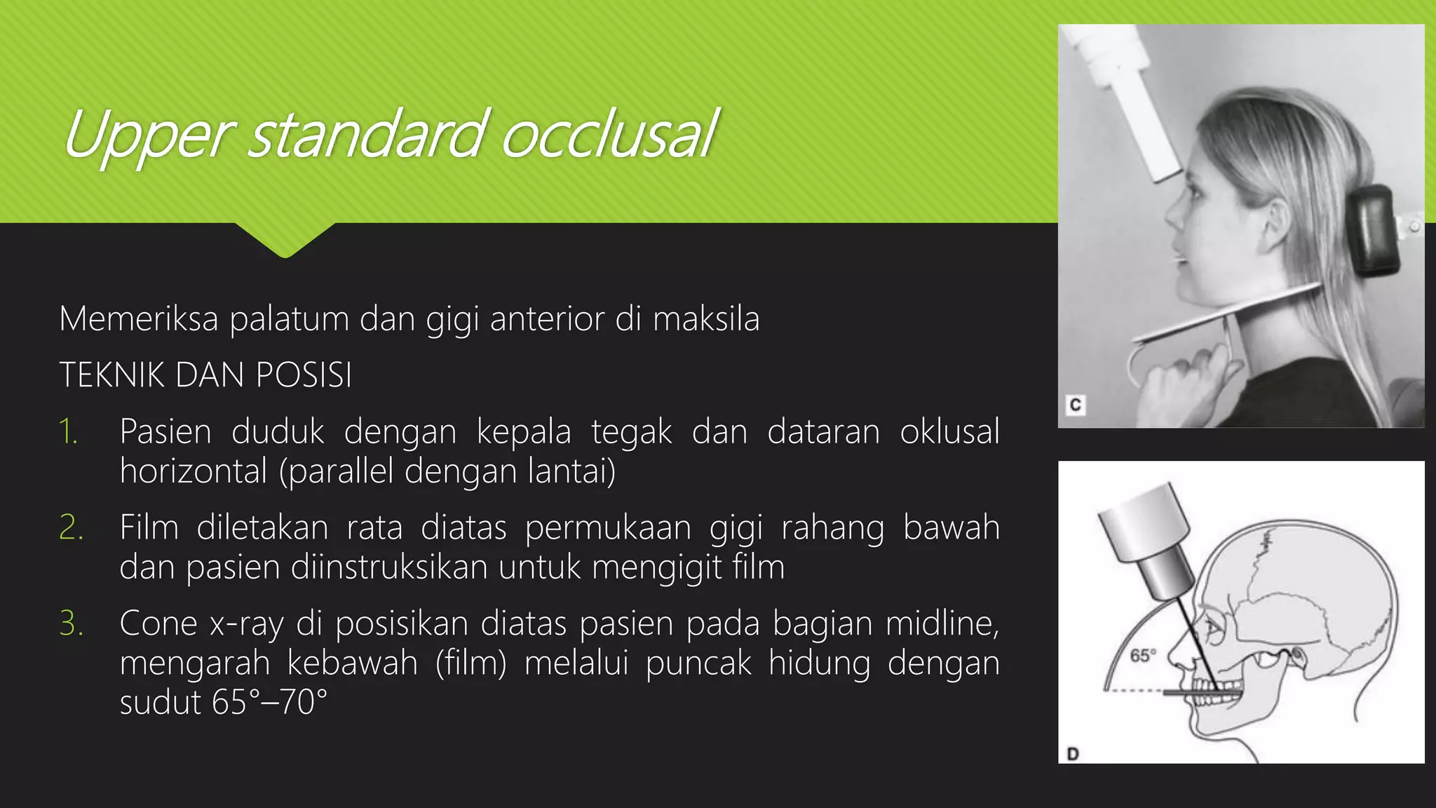 Occlusal Radiograph.pptx