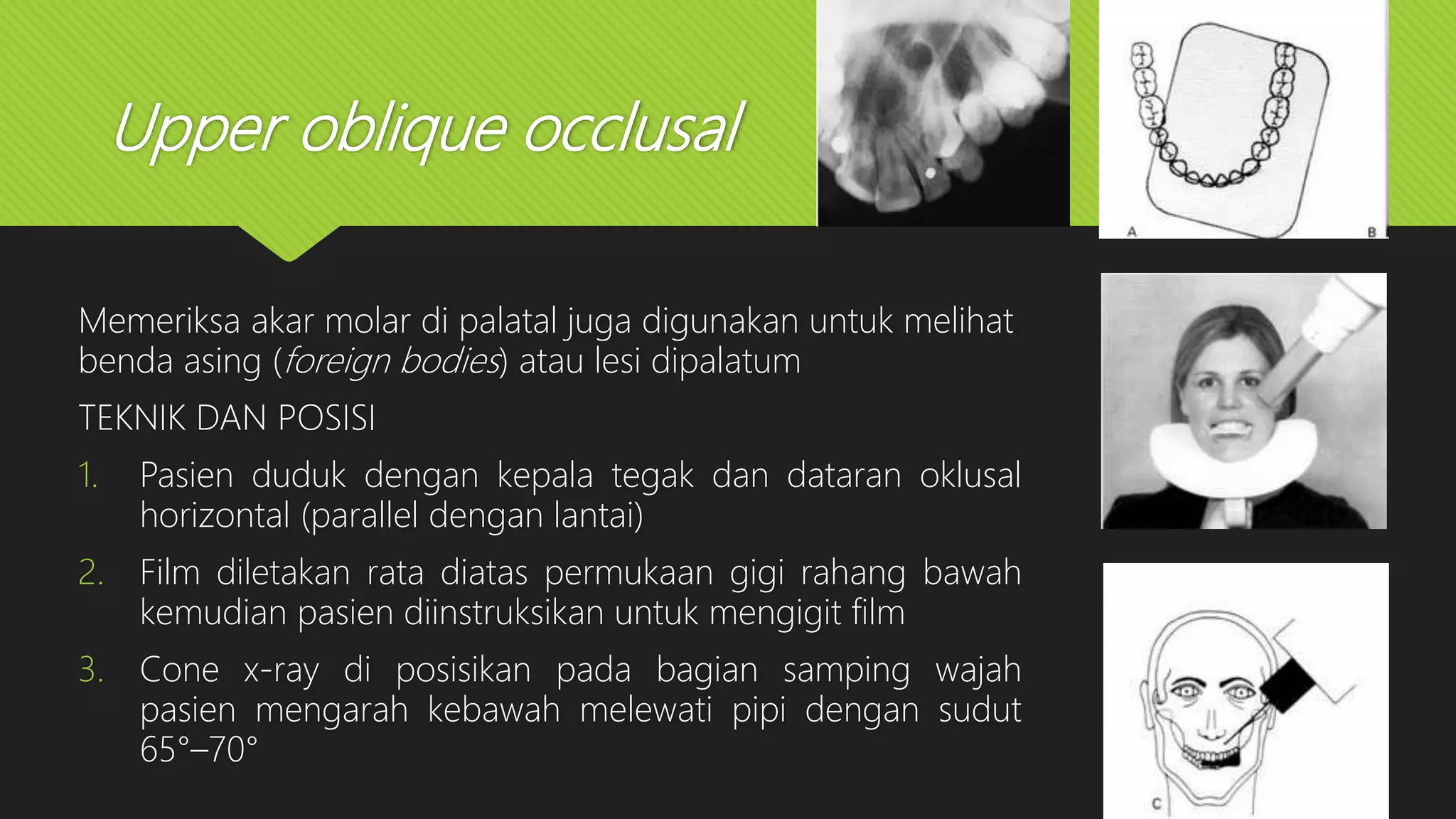 Occlusal Radiograph.pptx