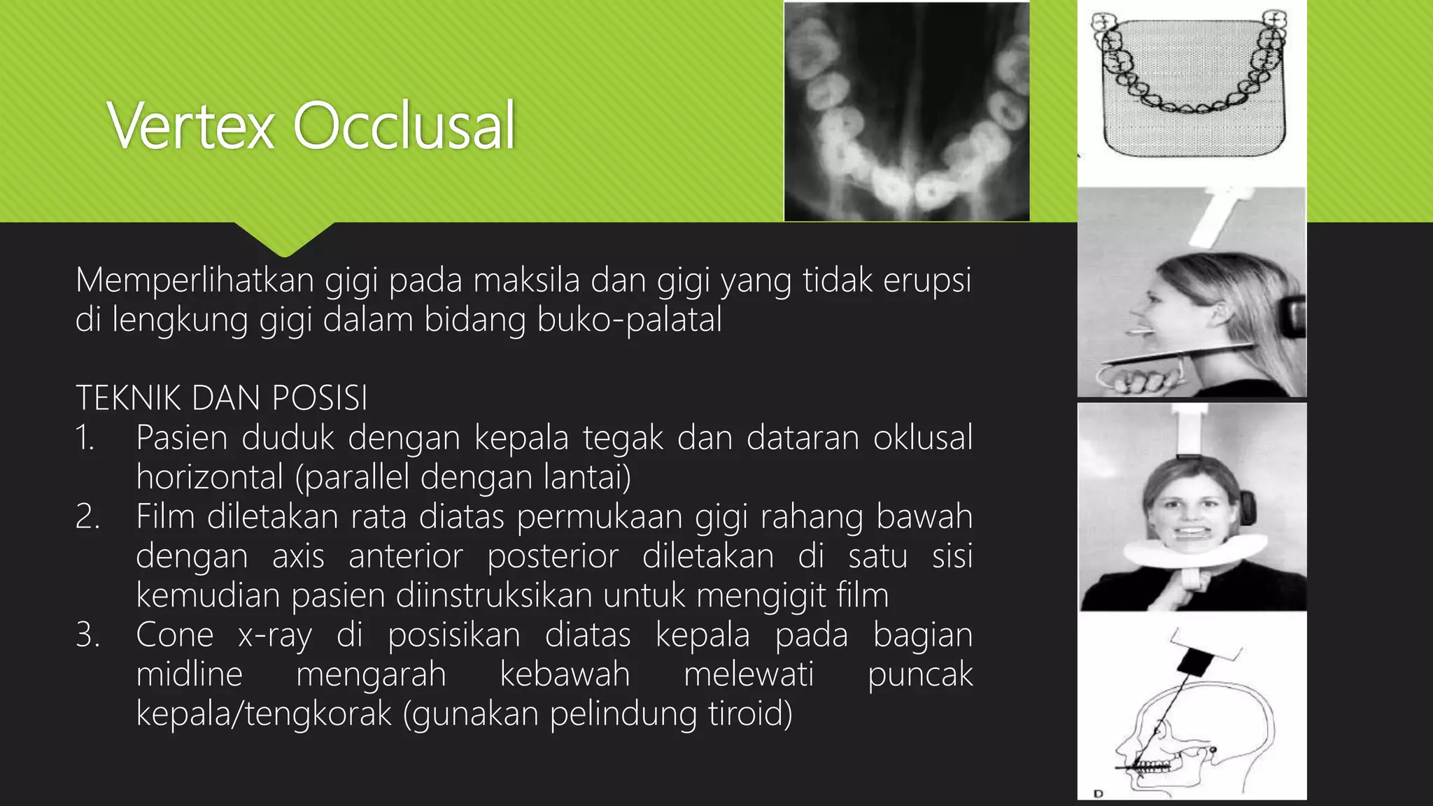Occlusal Radiograph.pptx