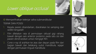 Occlusal Radiograph.pptx